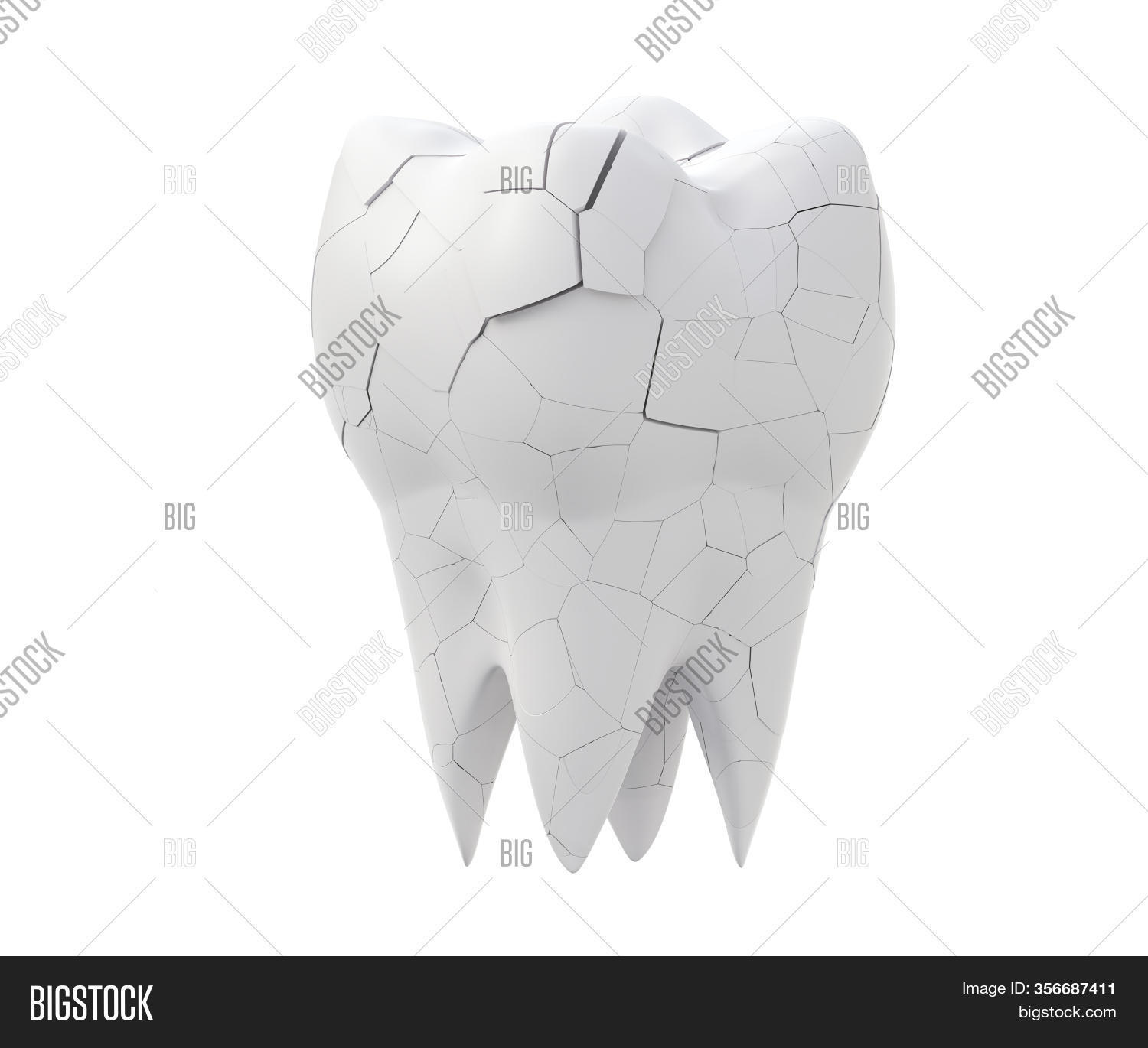Broken Molars Tooth Image & Photo (Free Trial) | Bigstock