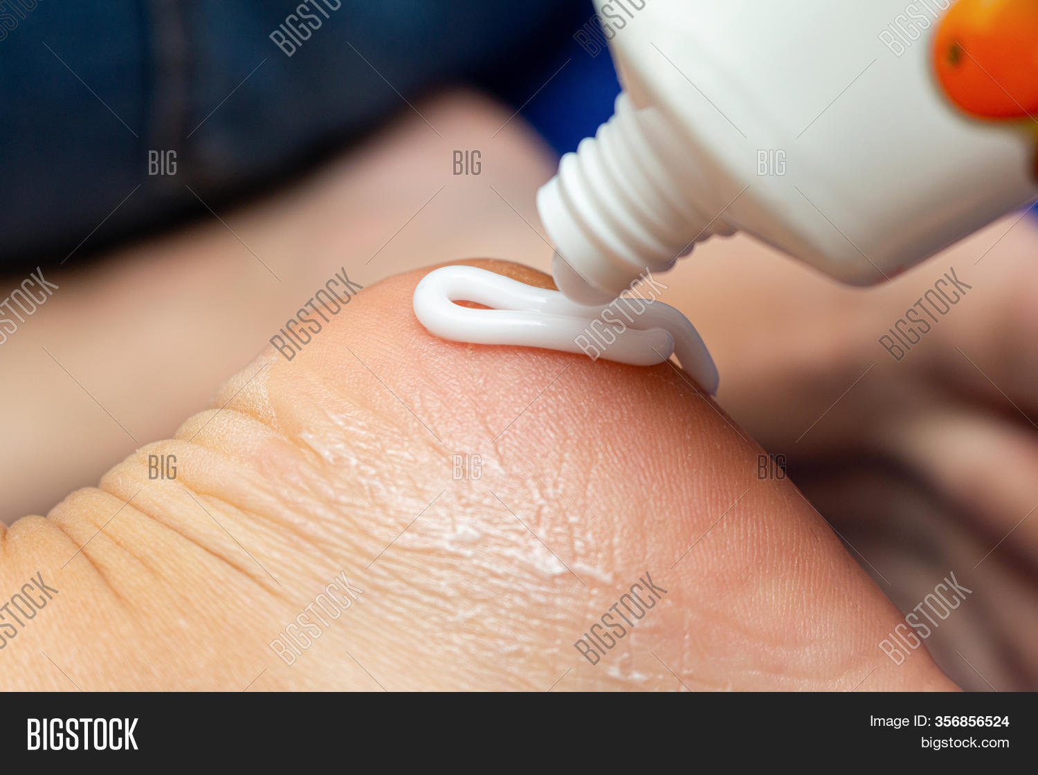 Applying Cream Tube On Image & Photo (Free Trial) | Bigstock