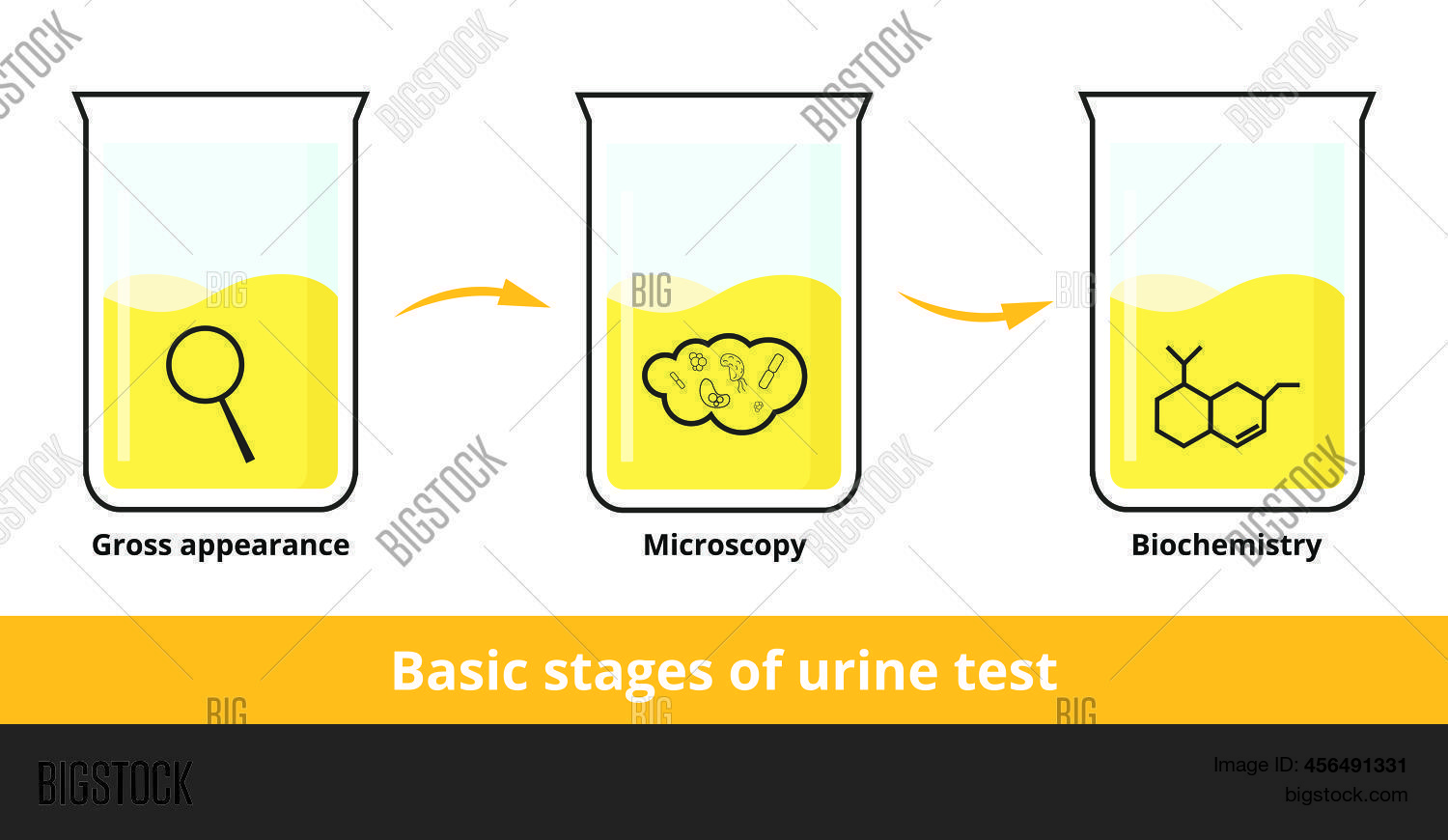 Basic Stages Urine Vector & Photo (Free Trial) | Bigstock