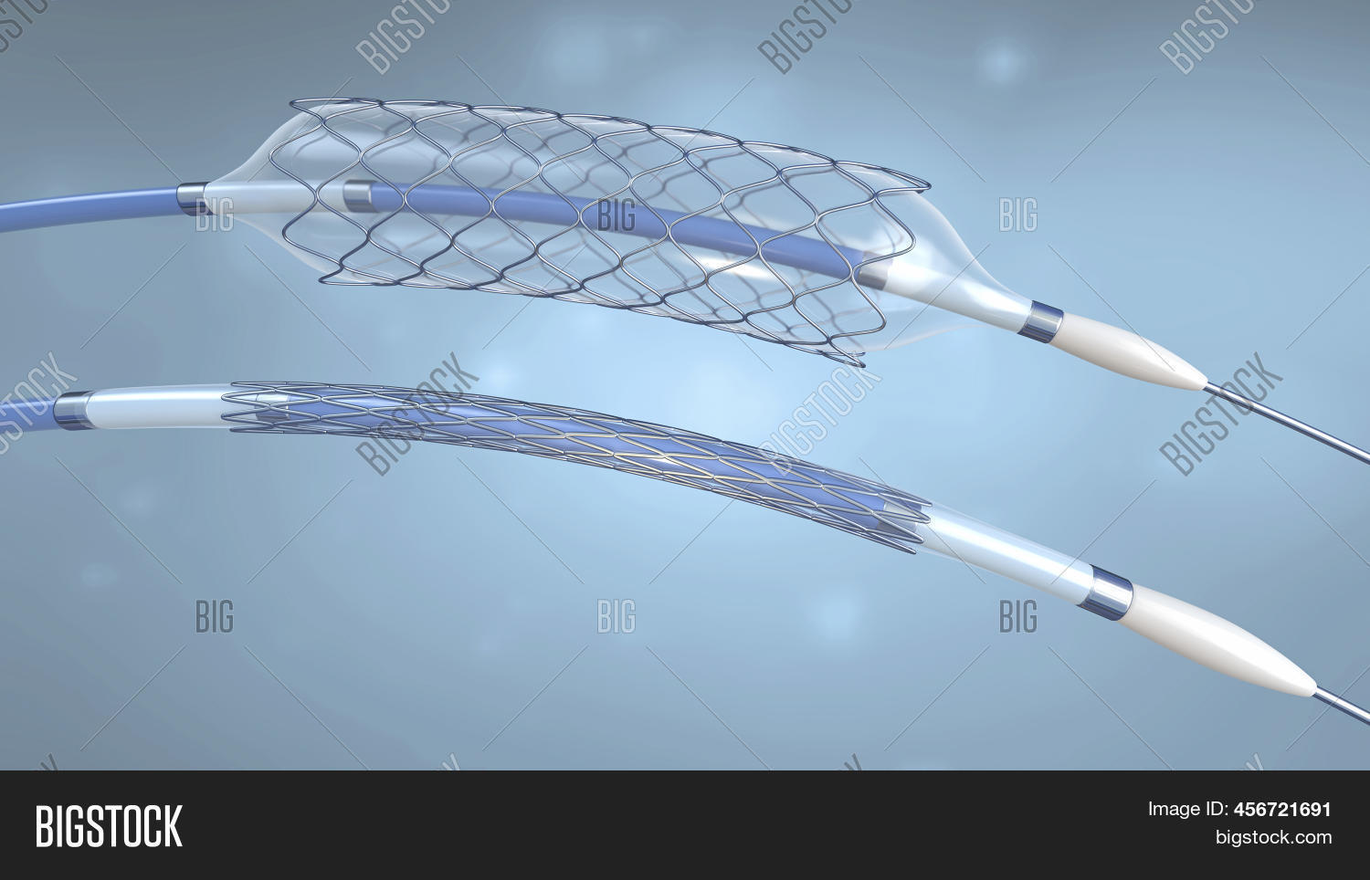 Stent Catheter Image & Photo (Free Trial) | Bigstock