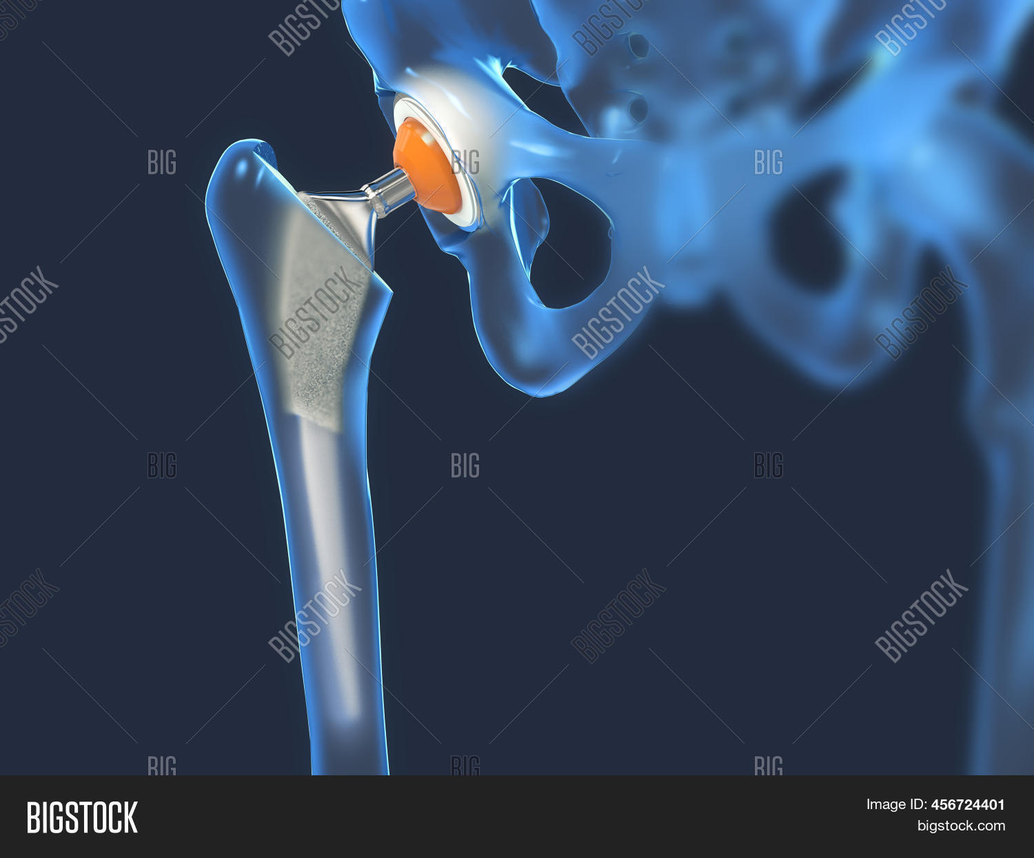 Function Hip Joint Image & Photo (Free Trial) | Bigstock