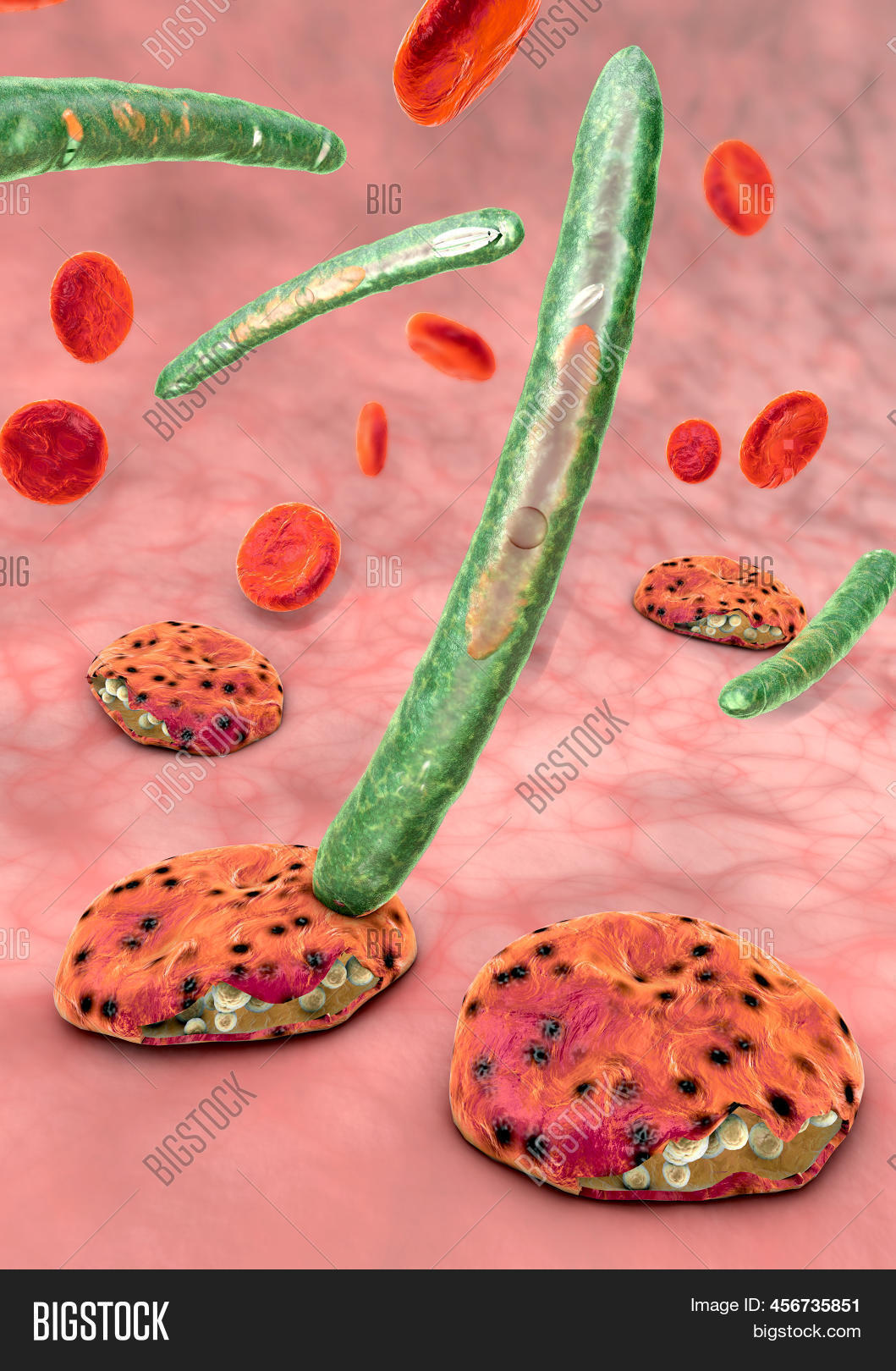 Infected Blood Cells Image & Photo (Free Trial) | Bigstock