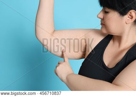 Obese Woman Flabby Arm Image & Photo (Free Trial) | Bigstock