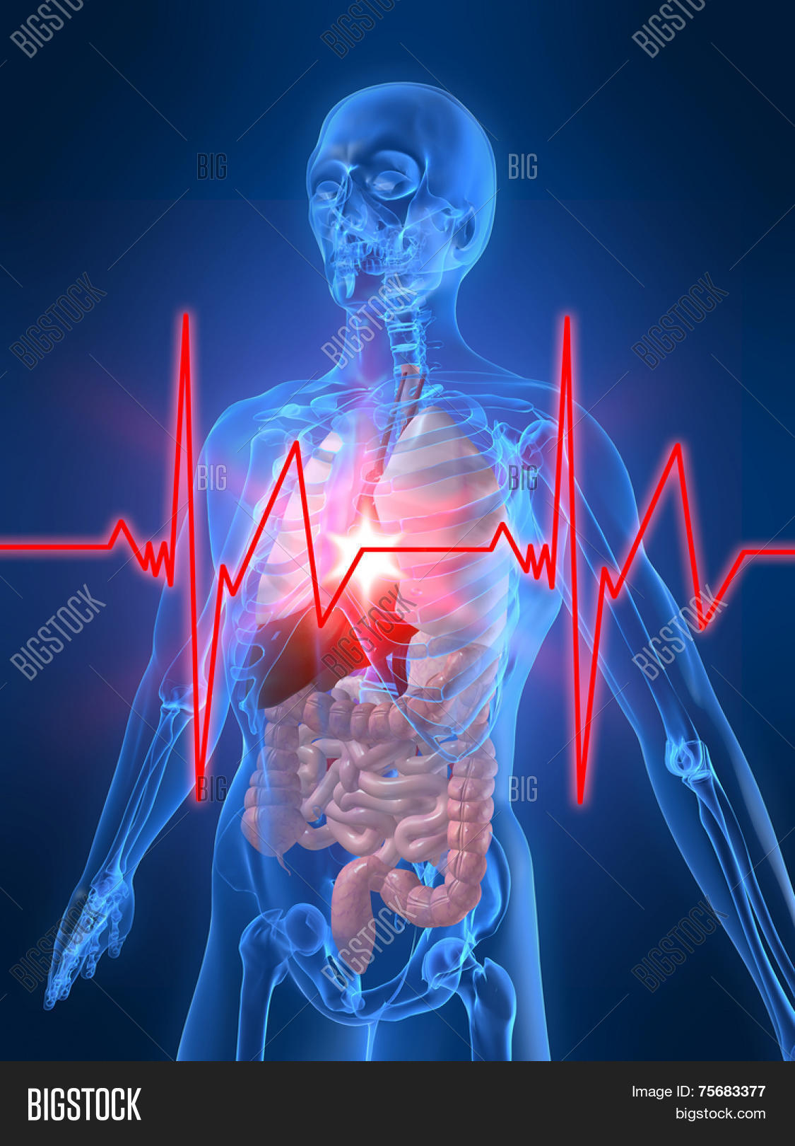 Heartbeat/heartattack Image & Photo (Free Trial) | Bigstock