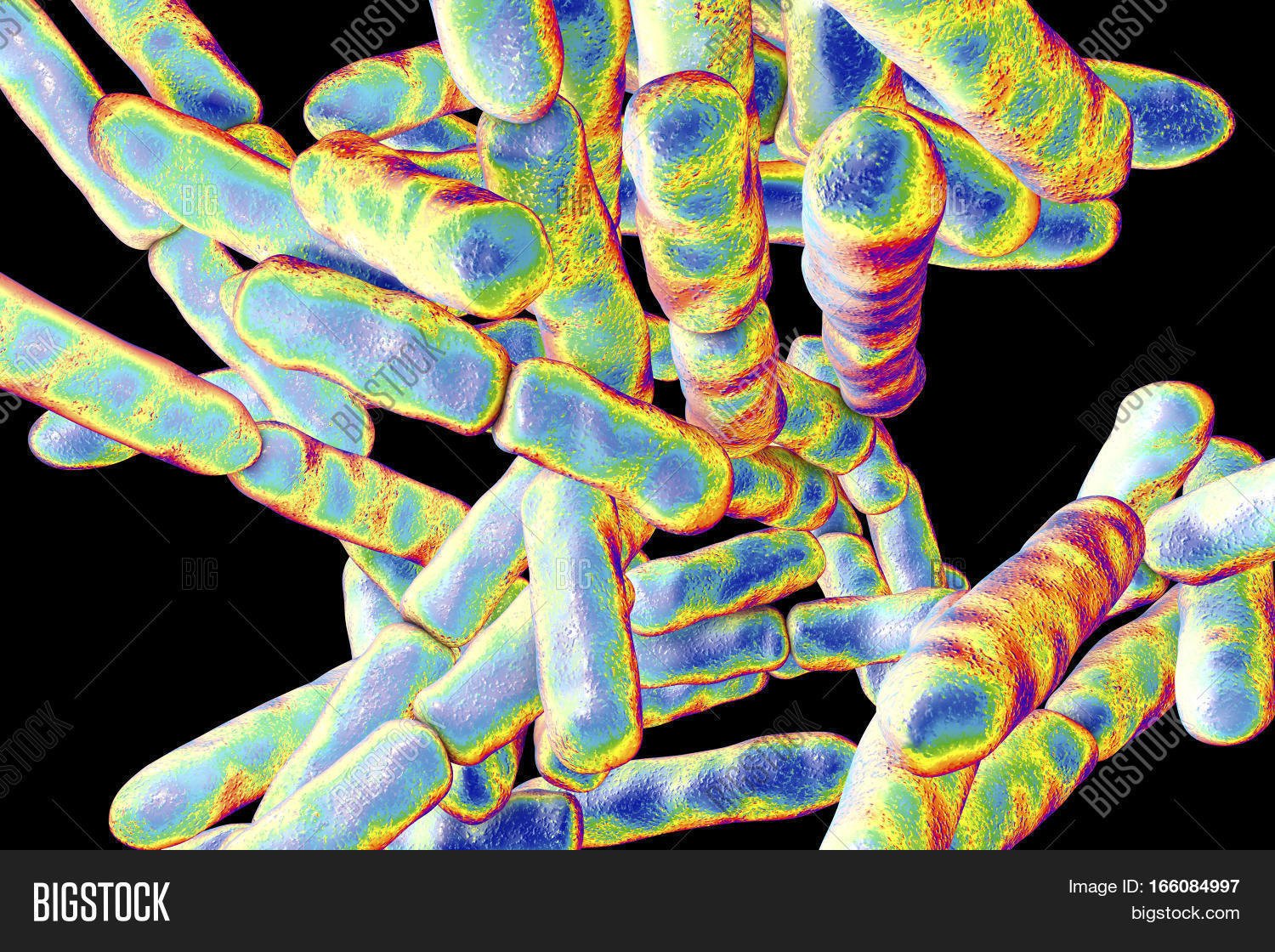Bifidobacterium Gram Stain