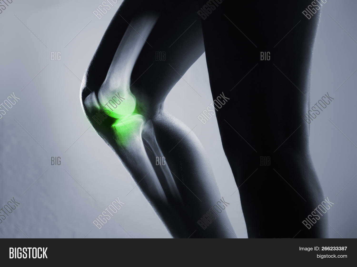 Human Knee Joint Leg X Image & Photo (Free Trial) | Bigstock