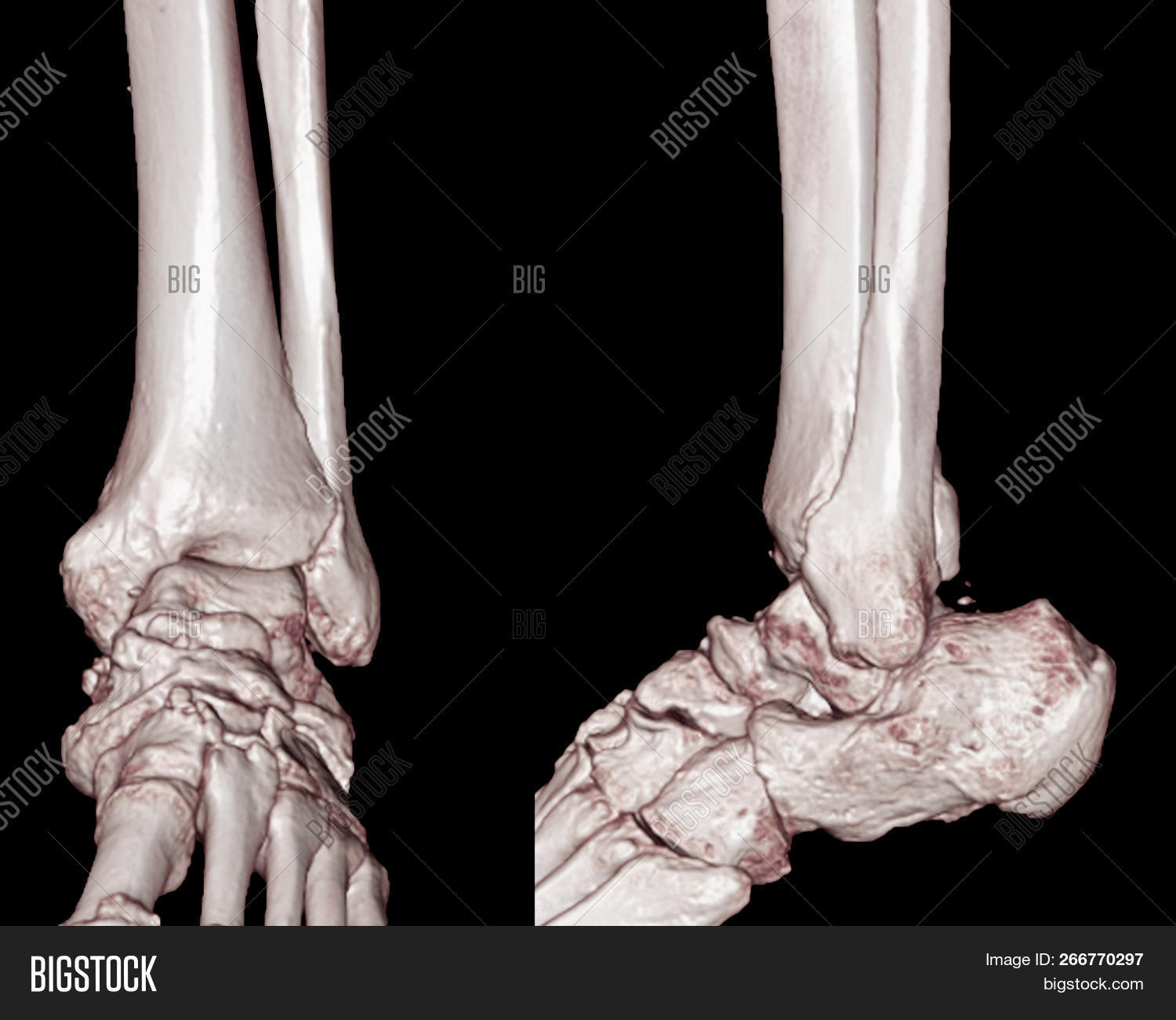 Ct Scan 3d Rendering Image & Photo (Free Trial) | Bigstock