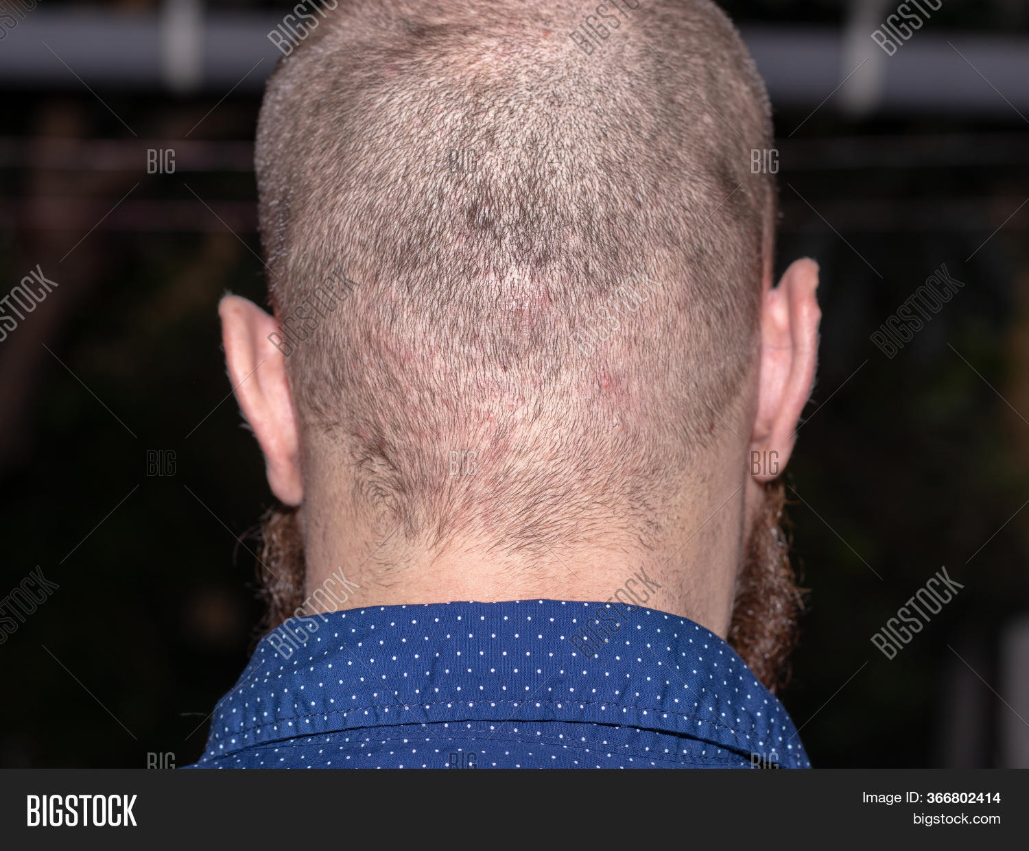 Back View Bald Man Image & Photo (Free Trial) | Bigstock