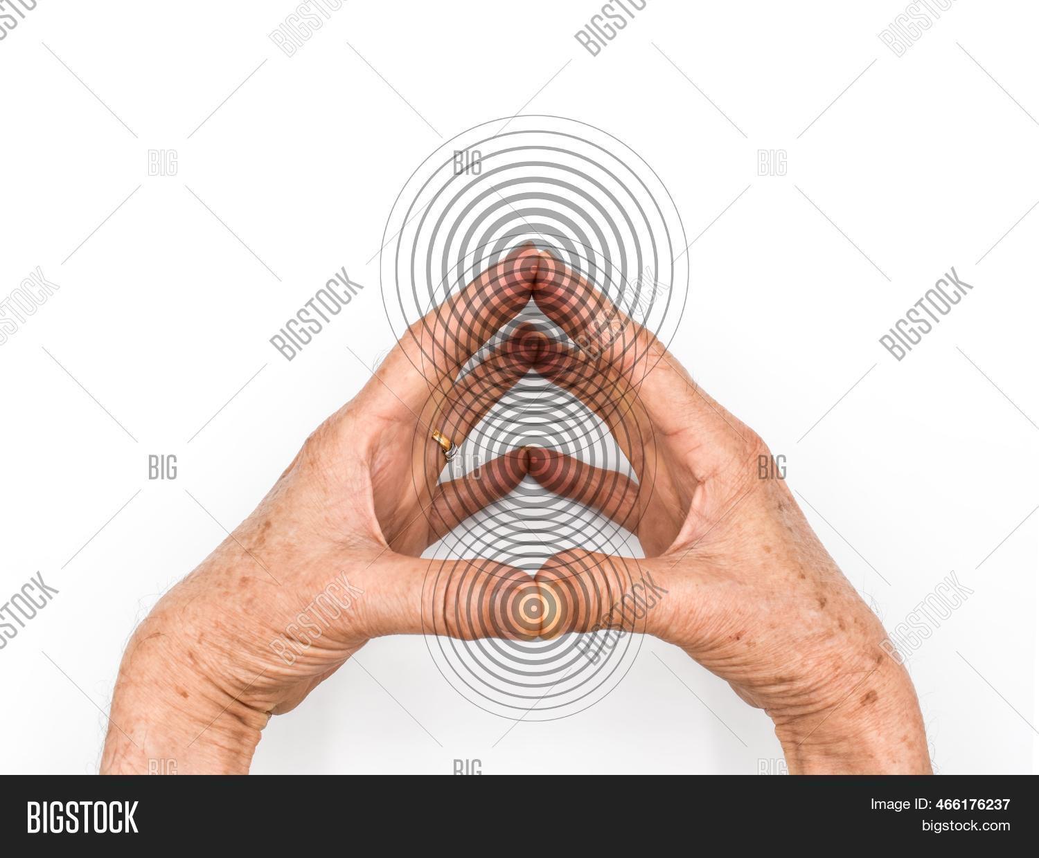 Tingling Numbness Image & Photo (Free Trial) | Bigstock