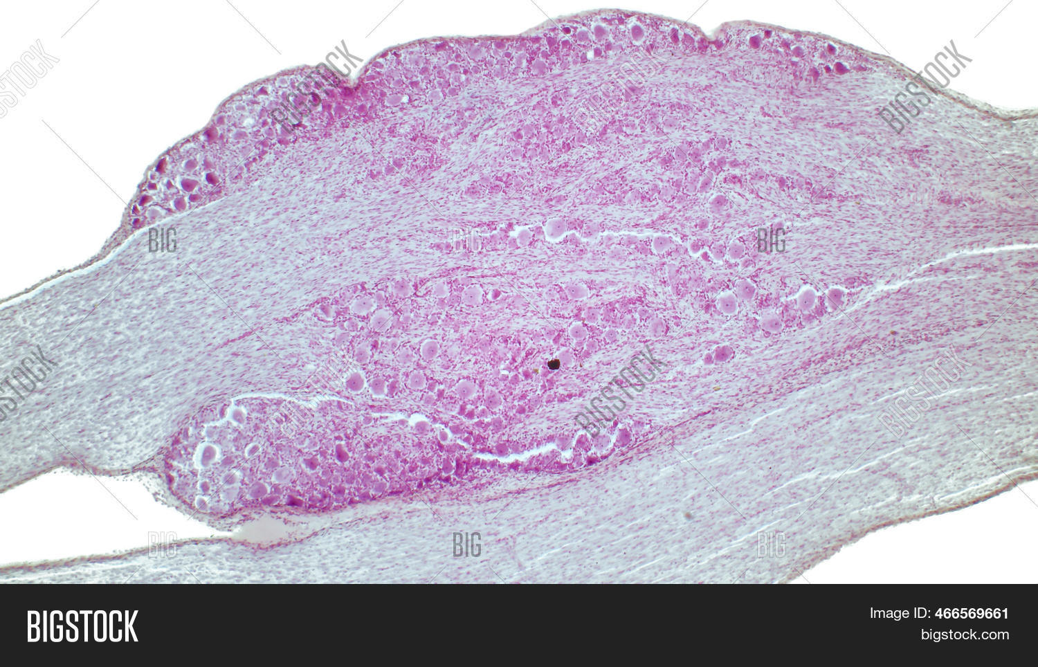 Pseudounipolar Neurons Image & Photo (Free Trial) | Bigstock