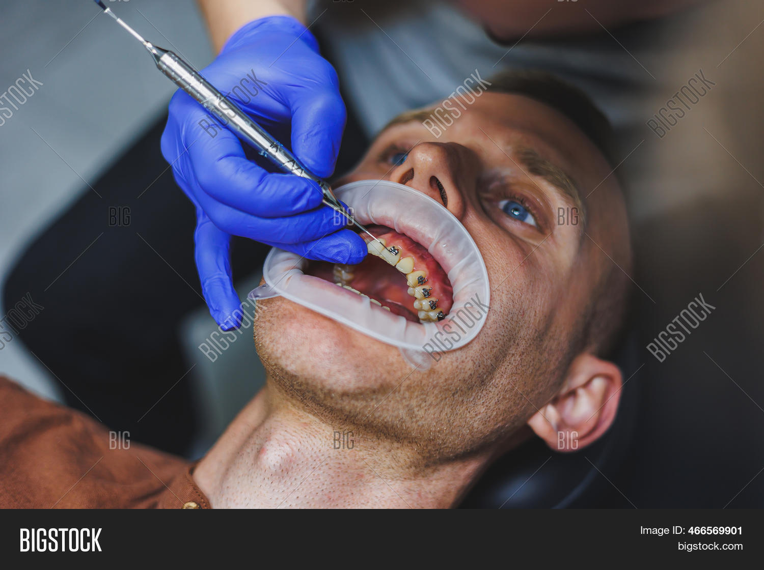 Dental Treatment Teeth Image & Photo (Free Trial) | Bigstock