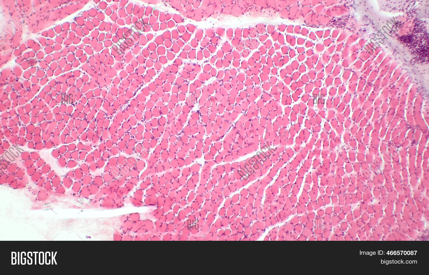 Light Micrograph Image & Photo (Free Trial) | Bigstock