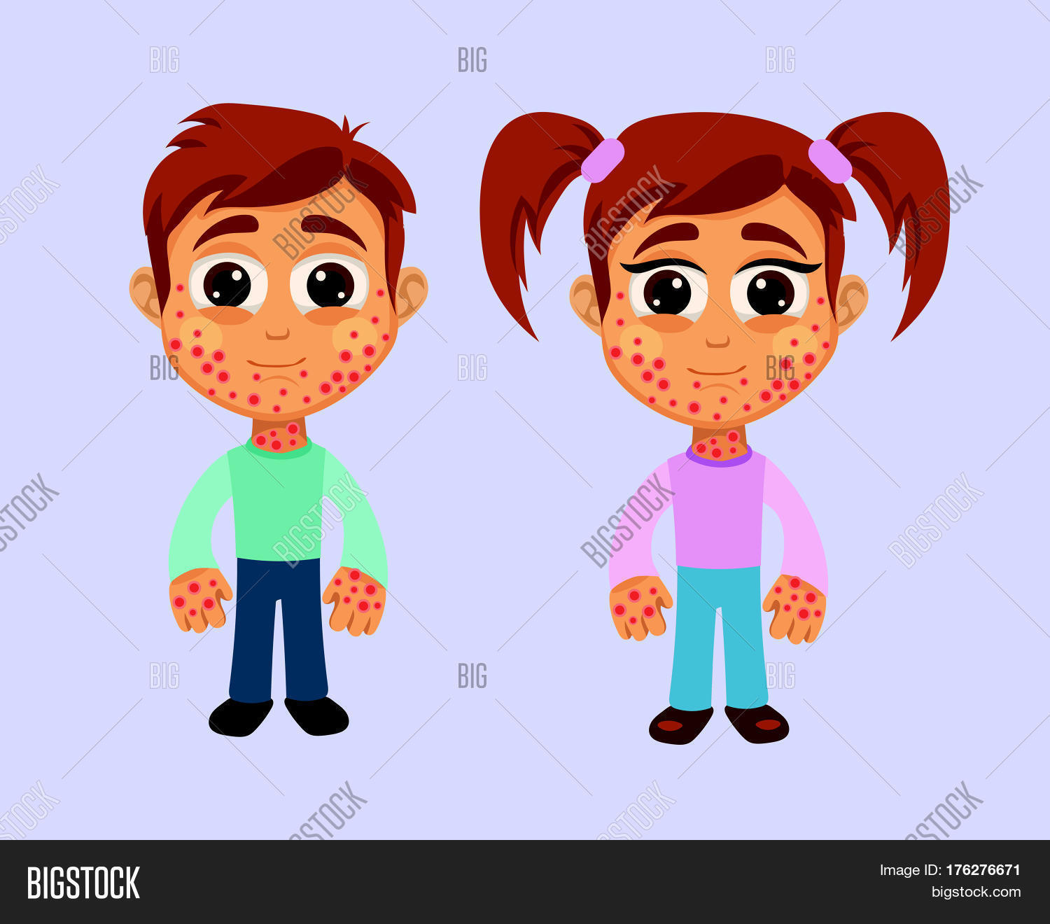 Rash Symptom. Boy Vector & Photo (Free Trial) | Bigstock