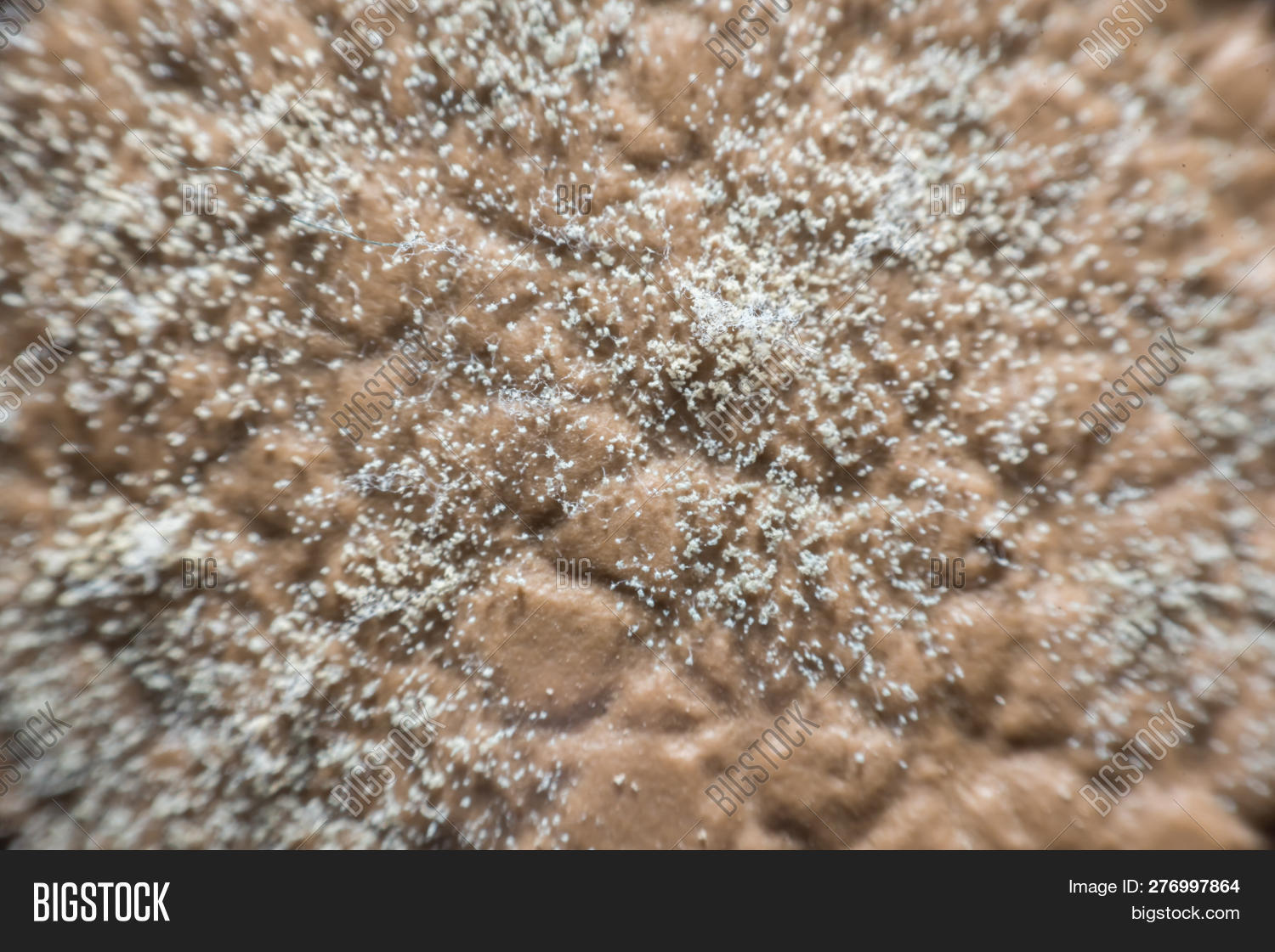 Macro Mold Spores Image & Photo (Free Trial) | Bigstock