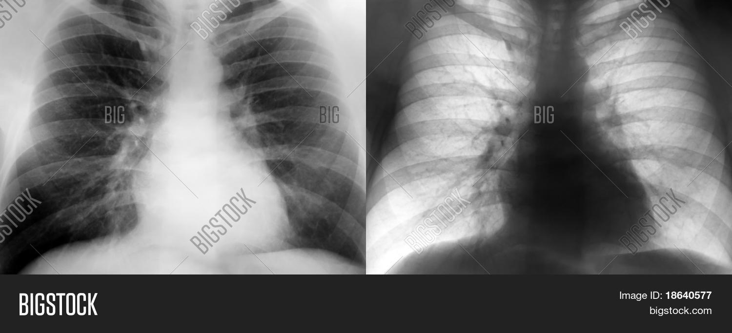 Imagen y foto Comparando Una (prueba gratis) | Bigstock