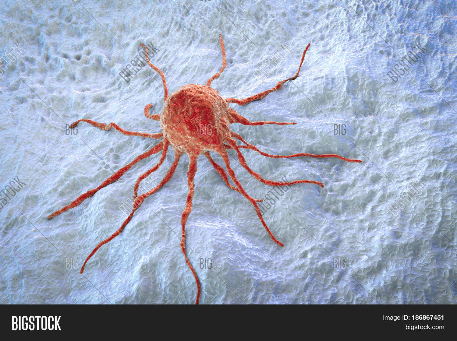 Cancer Cell, Tumour Image & Photo (Free Trial) | Bigstock