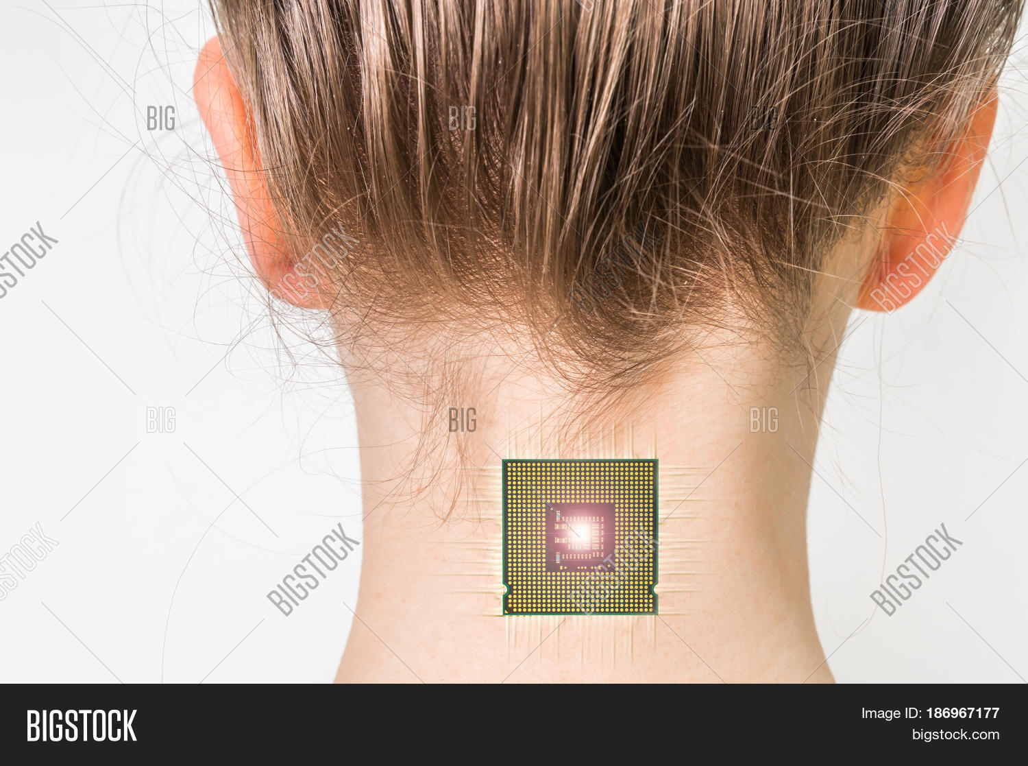 Bionic Microchip Image & Photo (Free Trial) | Bigstock