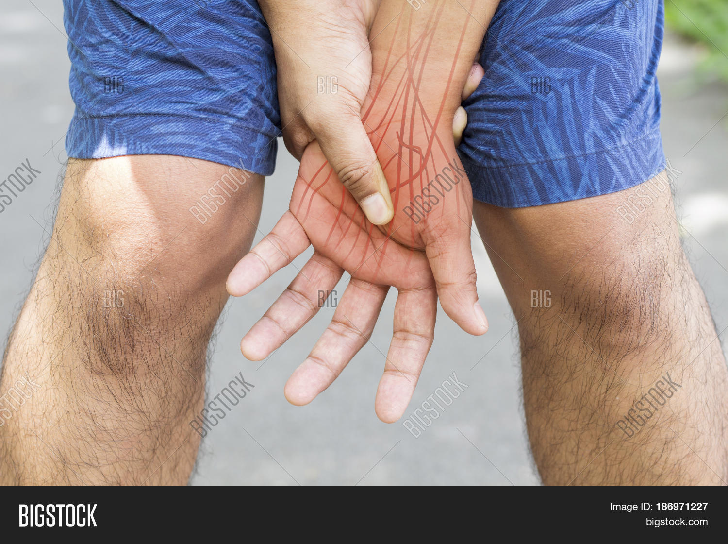 Hand Nerve Pain White Image & Photo (Free Trial) | Bigstock
