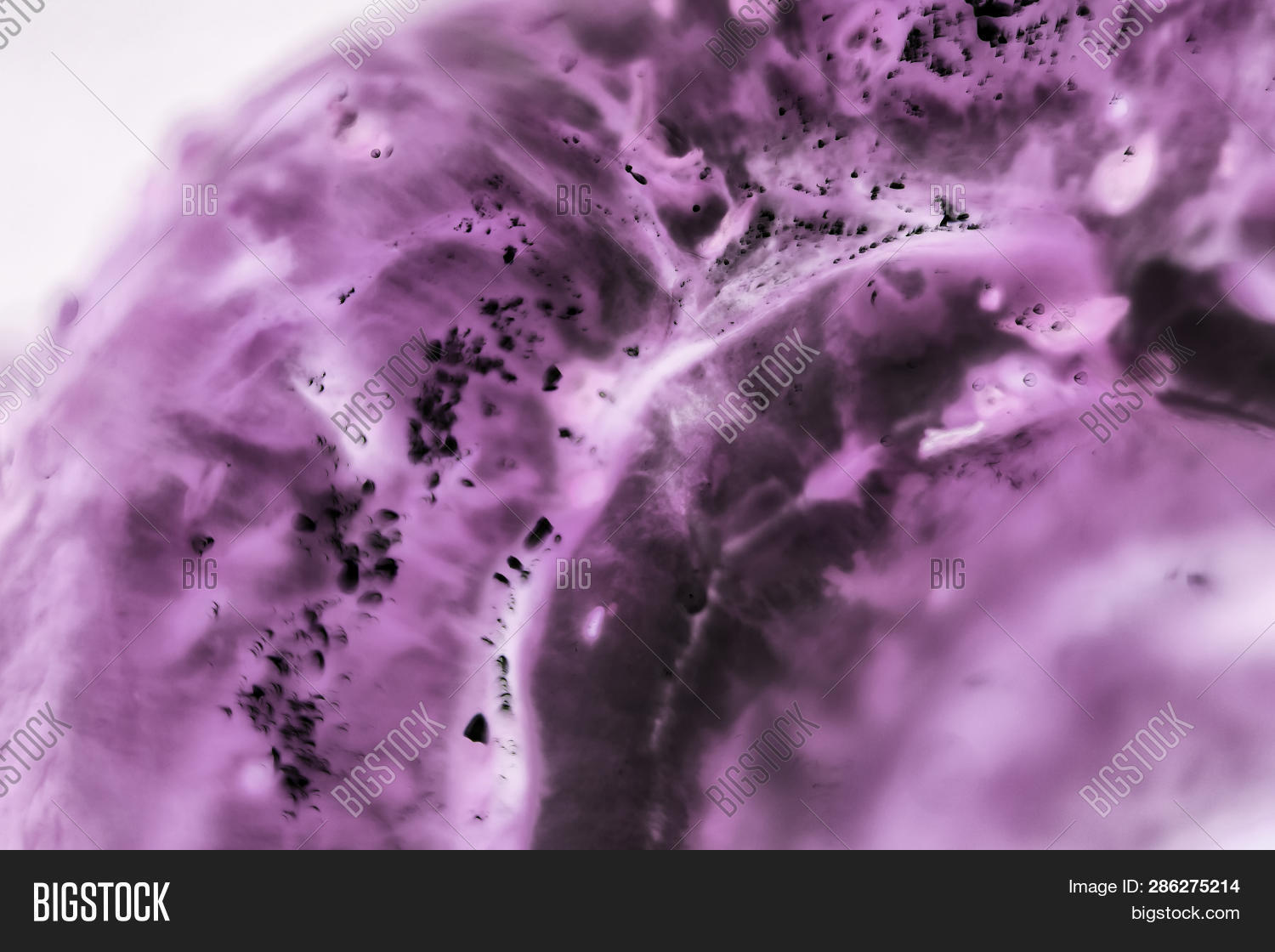 Mammary Cancer. Cancer Image & Photo (Free Trial) | Bigstock