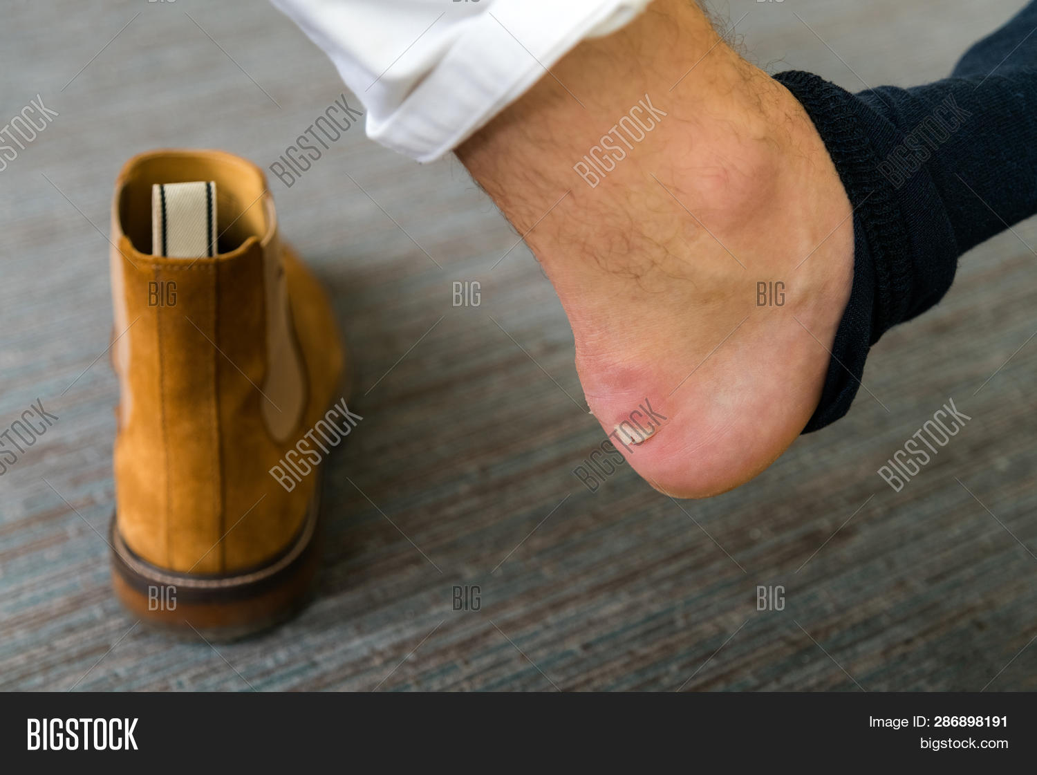 Painful Heel Wound On Image & Photo (Free Trial) | Bigstock
