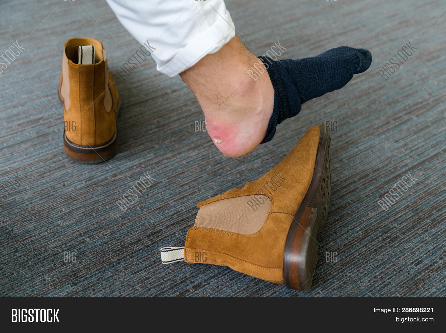 Painful Heel Wound On Image & Photo (Free Trial) | Bigstock