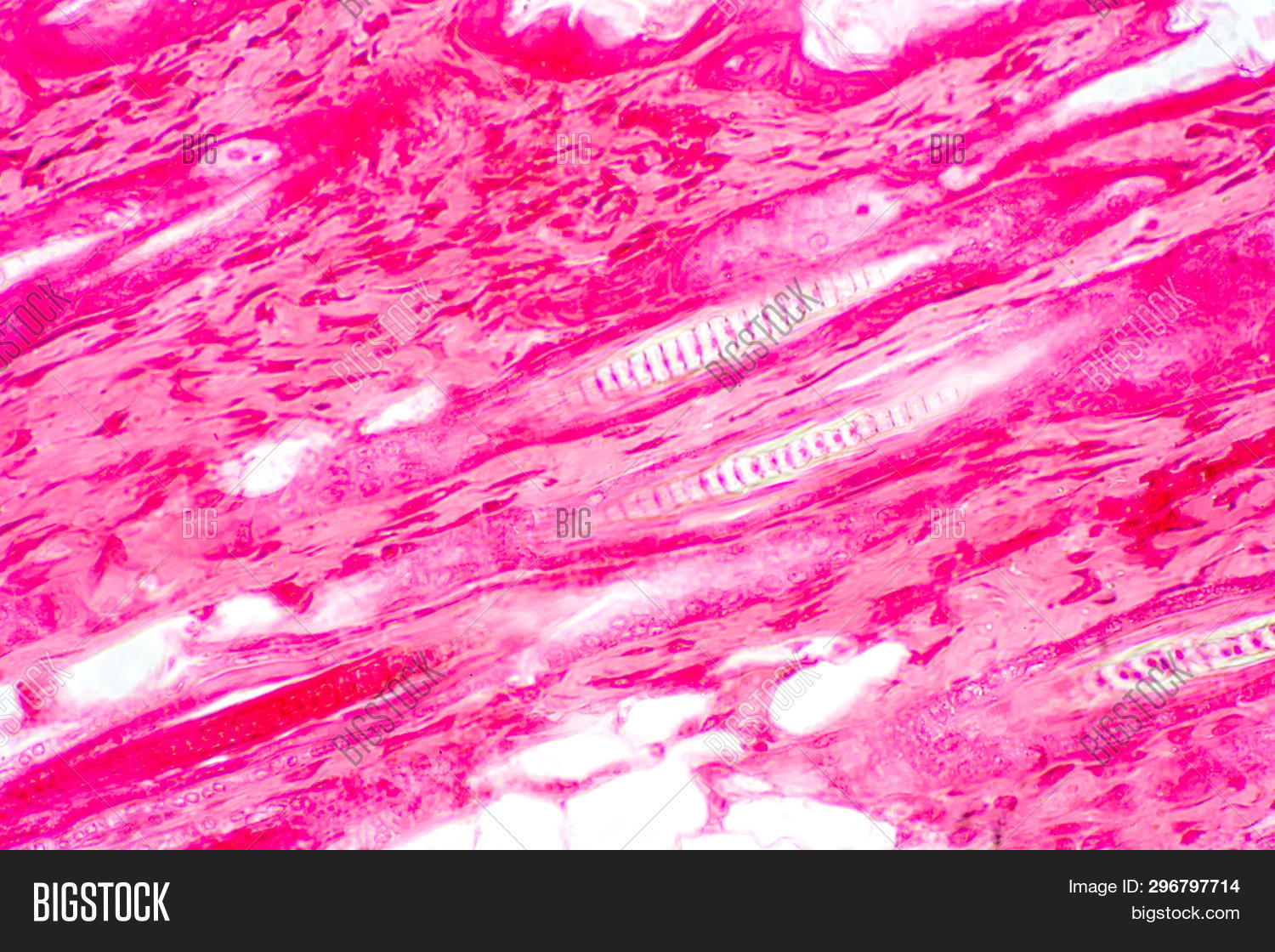 Cross Section Human Image & Photo (Free Trial) | Bigstock