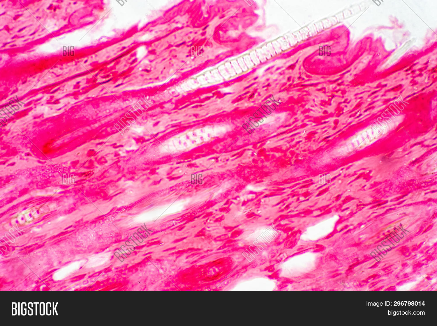 Cross Section Human Image & Photo (Free Trial) | Bigstock