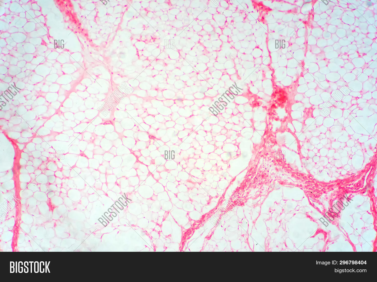 Human Fat Body Tissue Image & Photo (Free Trial) | Bigstock