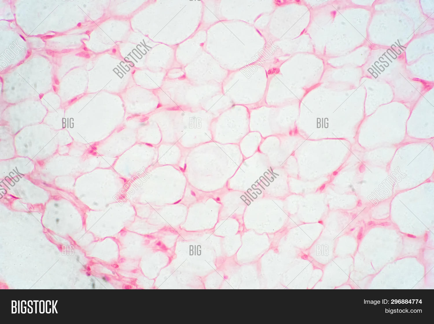Human Fat Body 图片和照片（免费试用） | Bigstock