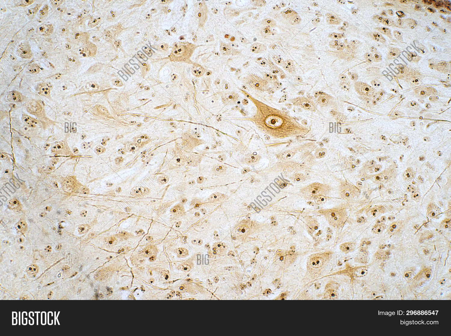 Cross Section Spinal Image & Photo (Free Trial) | Bigstock