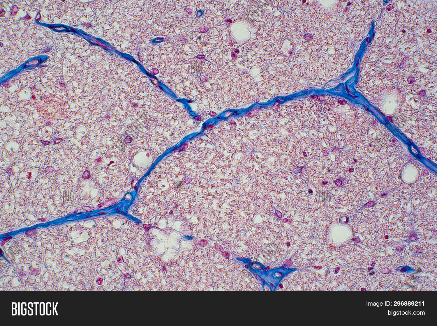 Human Eye Nerve Under Image & Photo (Free Trial) | Bigstock