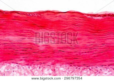 Knee Muscle, Tendon Image & Photo (Free Trial) | Bigstock