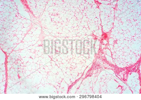 Human Fat Body Tissue Image & Photo (Free Trial) | Bigstock