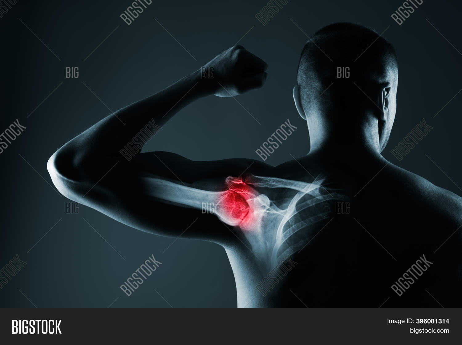 Human Shoulder Joint Images at Clarence Valladares blog