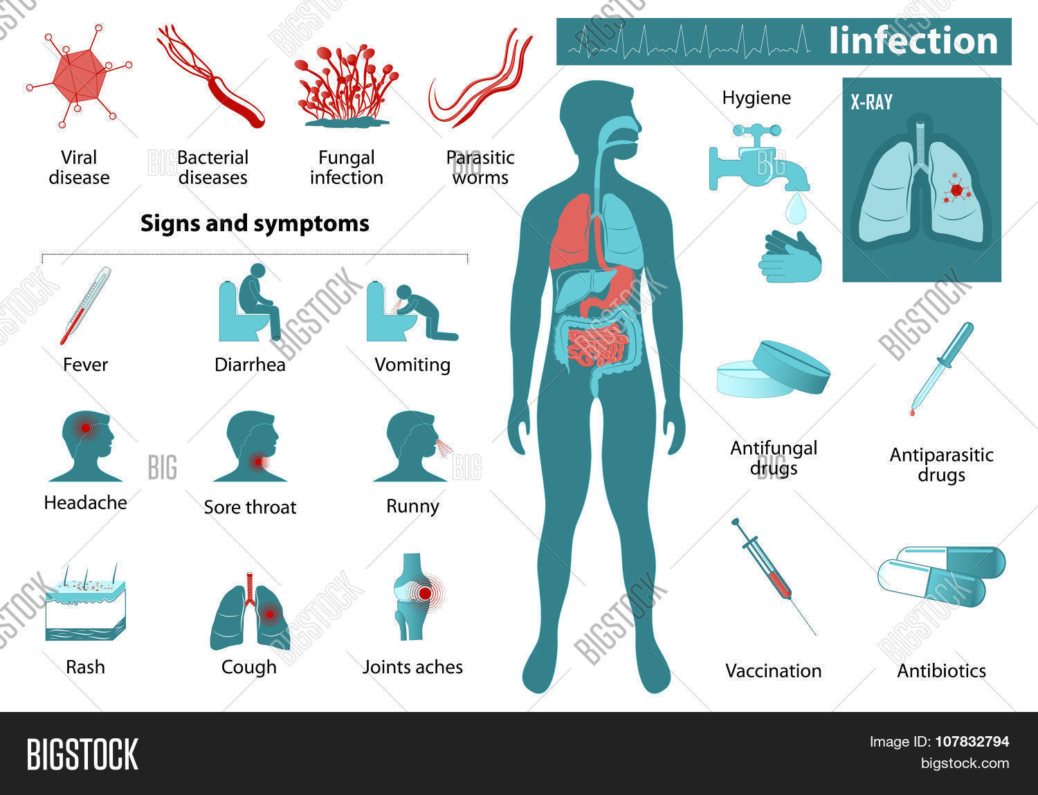Infection Vector & Photo (Free Trial) | Bigstock