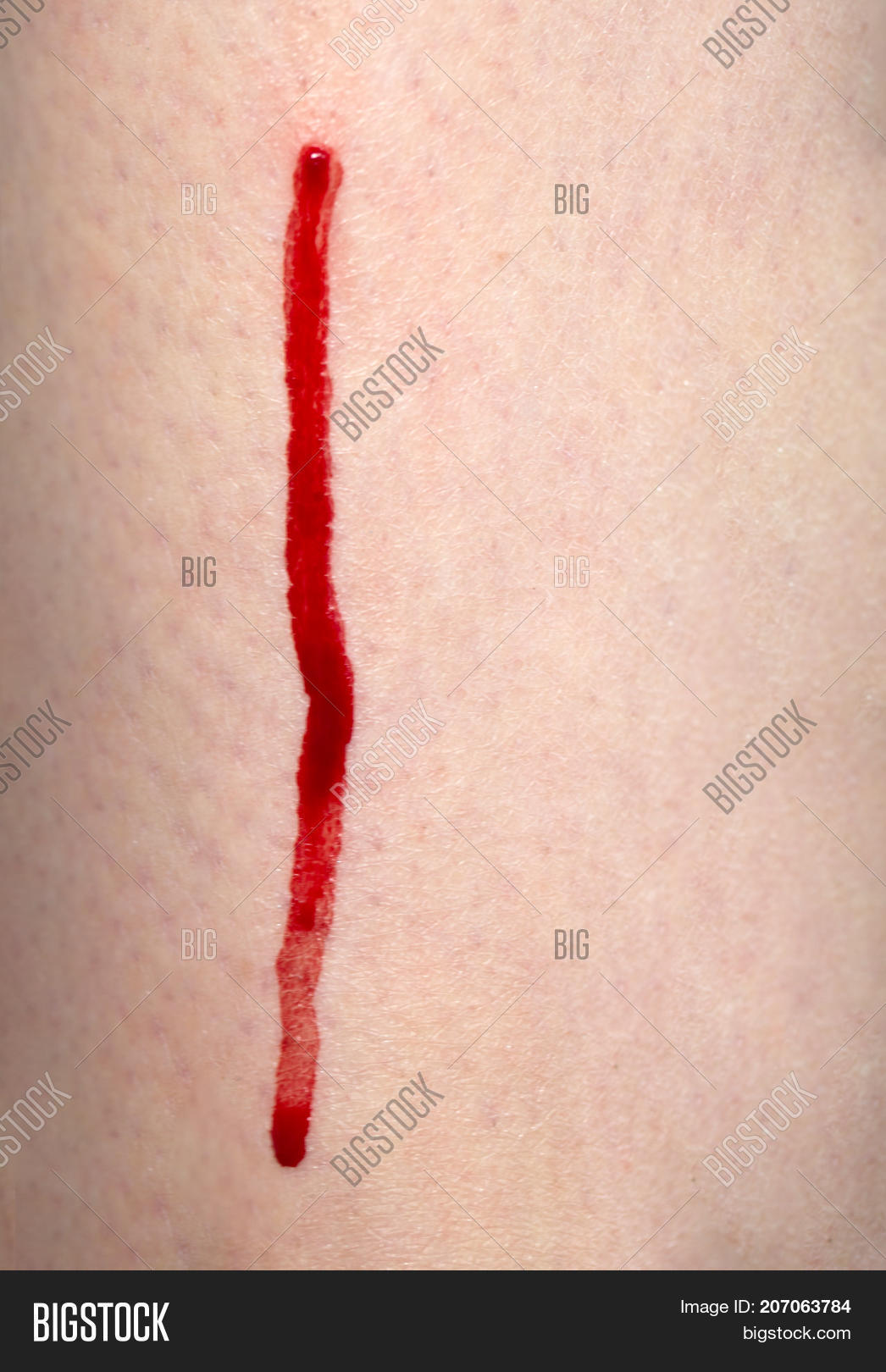 Imagen y foto Blood Wound Skin (prueba gratis) | Bigstock