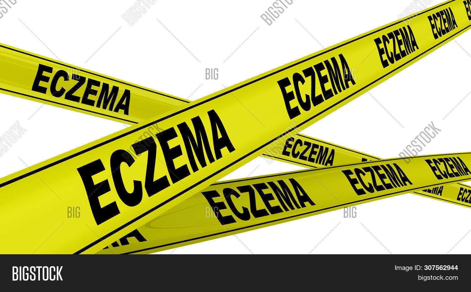 Eczema. Yellow Warning Image & Photo (Free Trial) | Bigstock