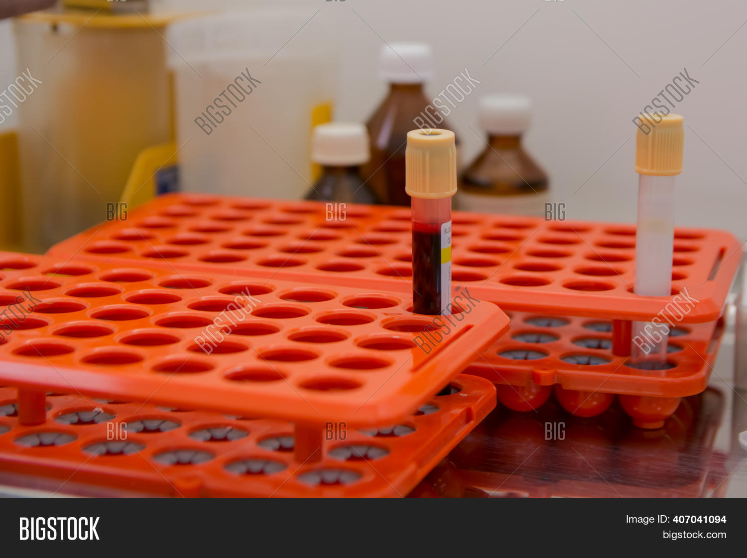 Vacutainer Human Blood Image & Photo (Free Trial) | Bigstock