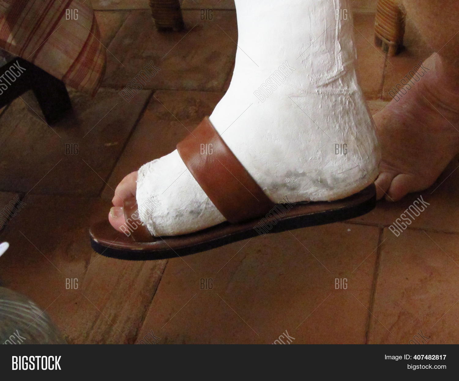 Person Plaster Cast On Image & Photo (Free Trial) | Bigstock