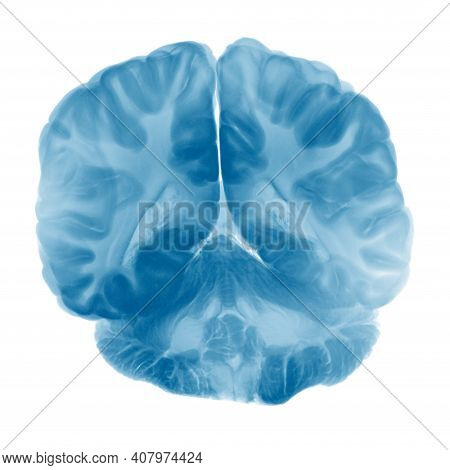 Cross Section Brain Image & Photo (Free Trial) | Bigstock