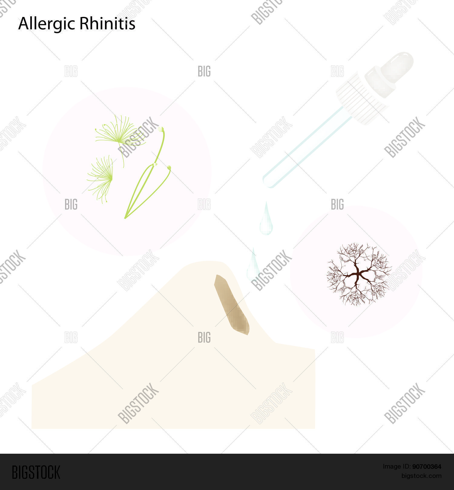Allergic Rhinitis Vector & Photo (Free Trial) | Bigstock