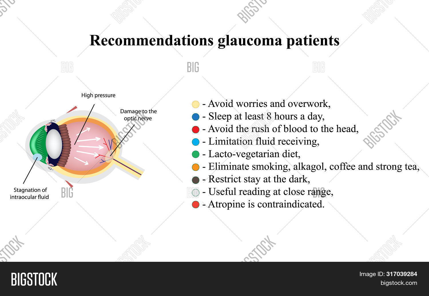Glaucoma. Image & Photo (Free Trial) | Bigstock