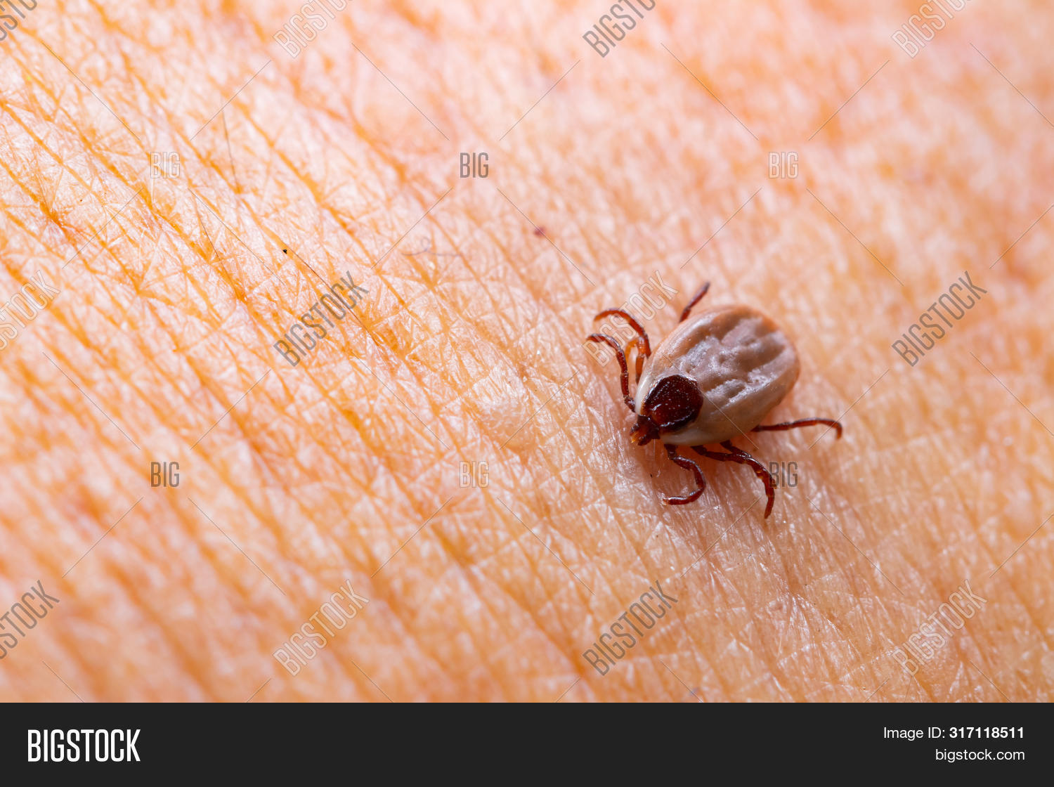 Tick Filled Blood Image & Photo (Free Trial) | Bigstock
