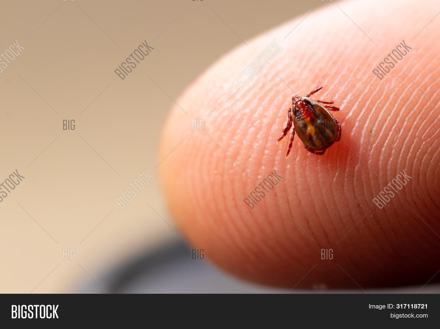 Tick Filled Blood Image & Photo (Free Trial) | Bigstock