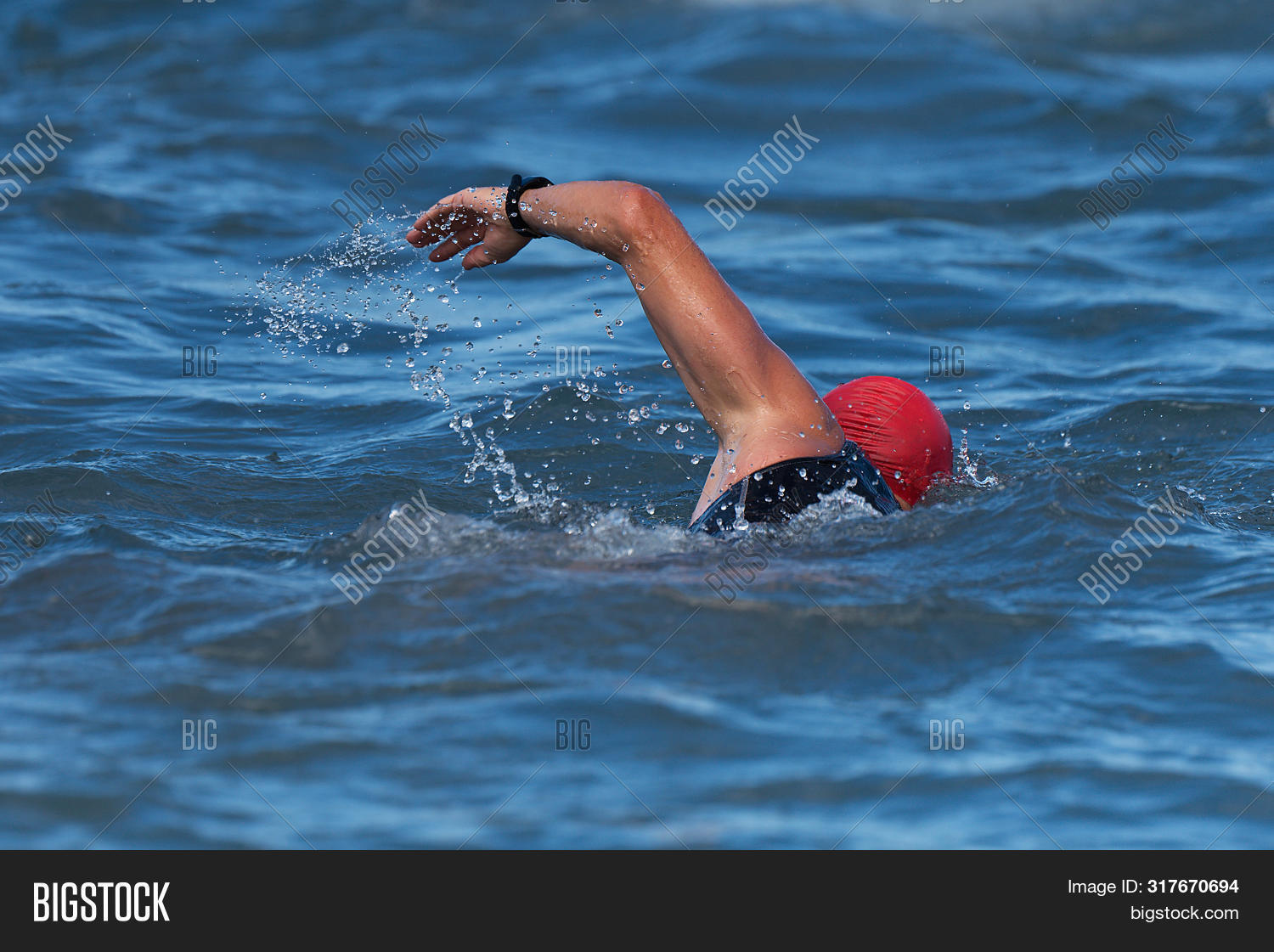 White Arm Caucasian Image & Photo (Free Trial) | Bigstock
