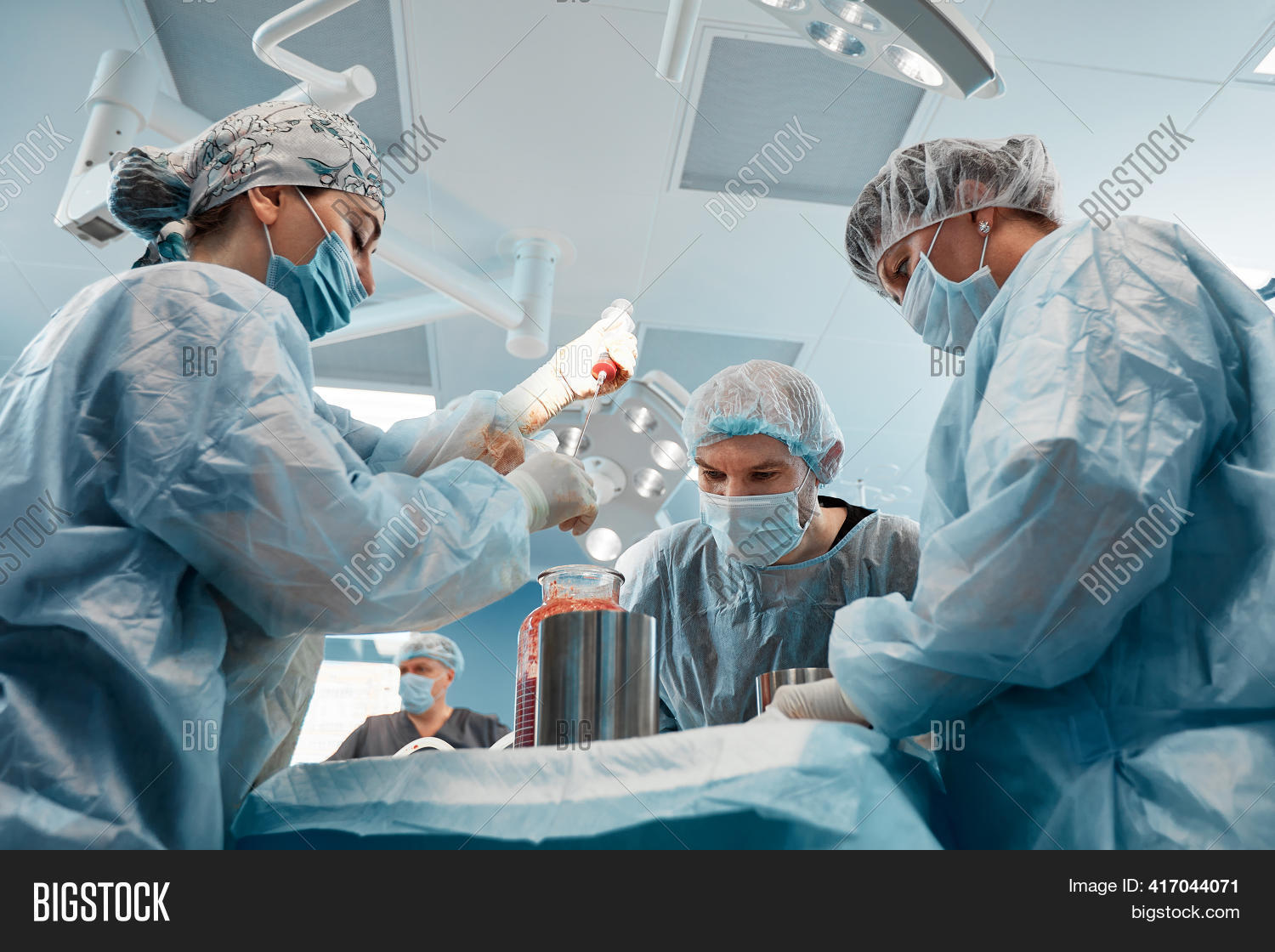 Cosmetic Liposuction Image & Photo (Free Trial) | Bigstock