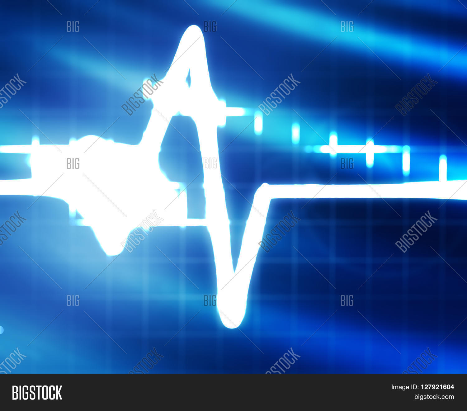 Heart Monitor Image & Photo (Free Trial) | Bigstock