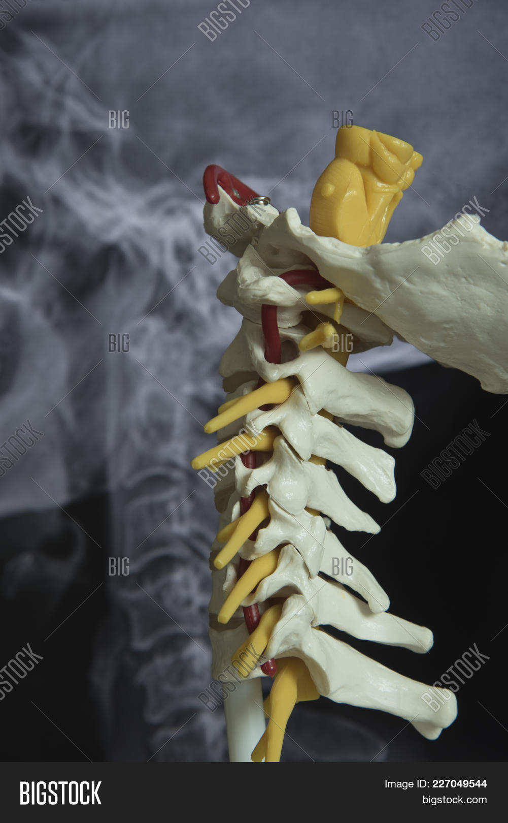 Human Cervical Spine Image & Photo (Free Trial) | Bigstock