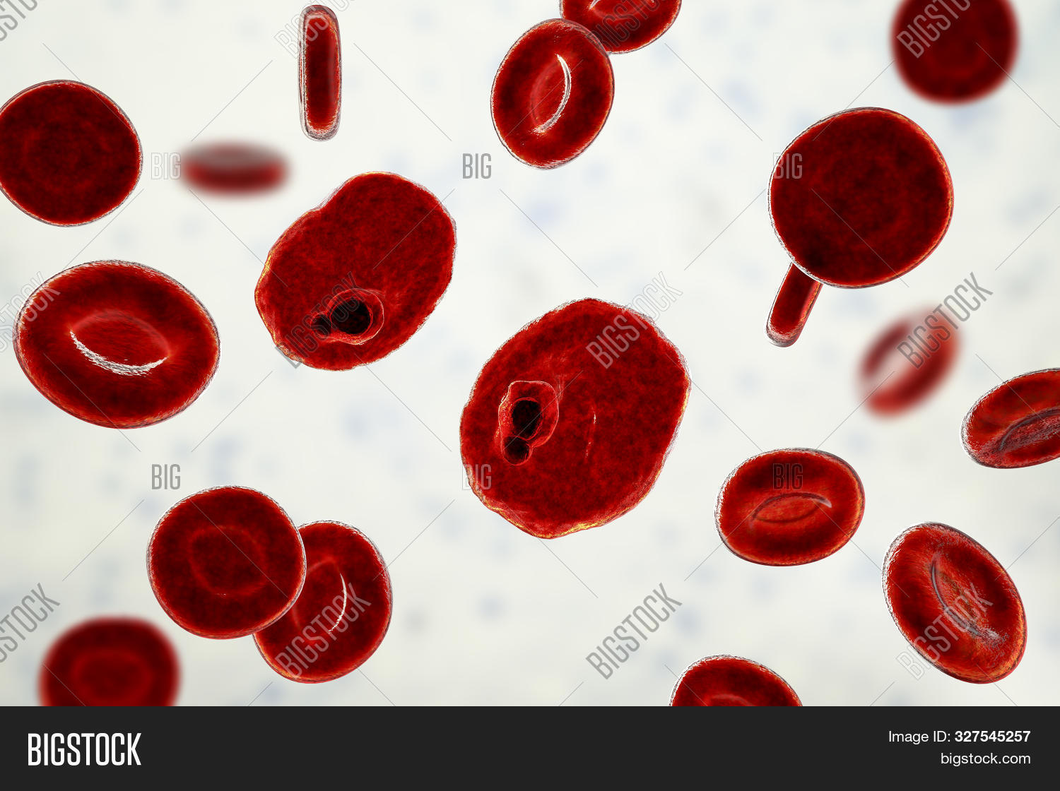Malaria-infected Red Image & Photo (Free Trial) | Bigstock