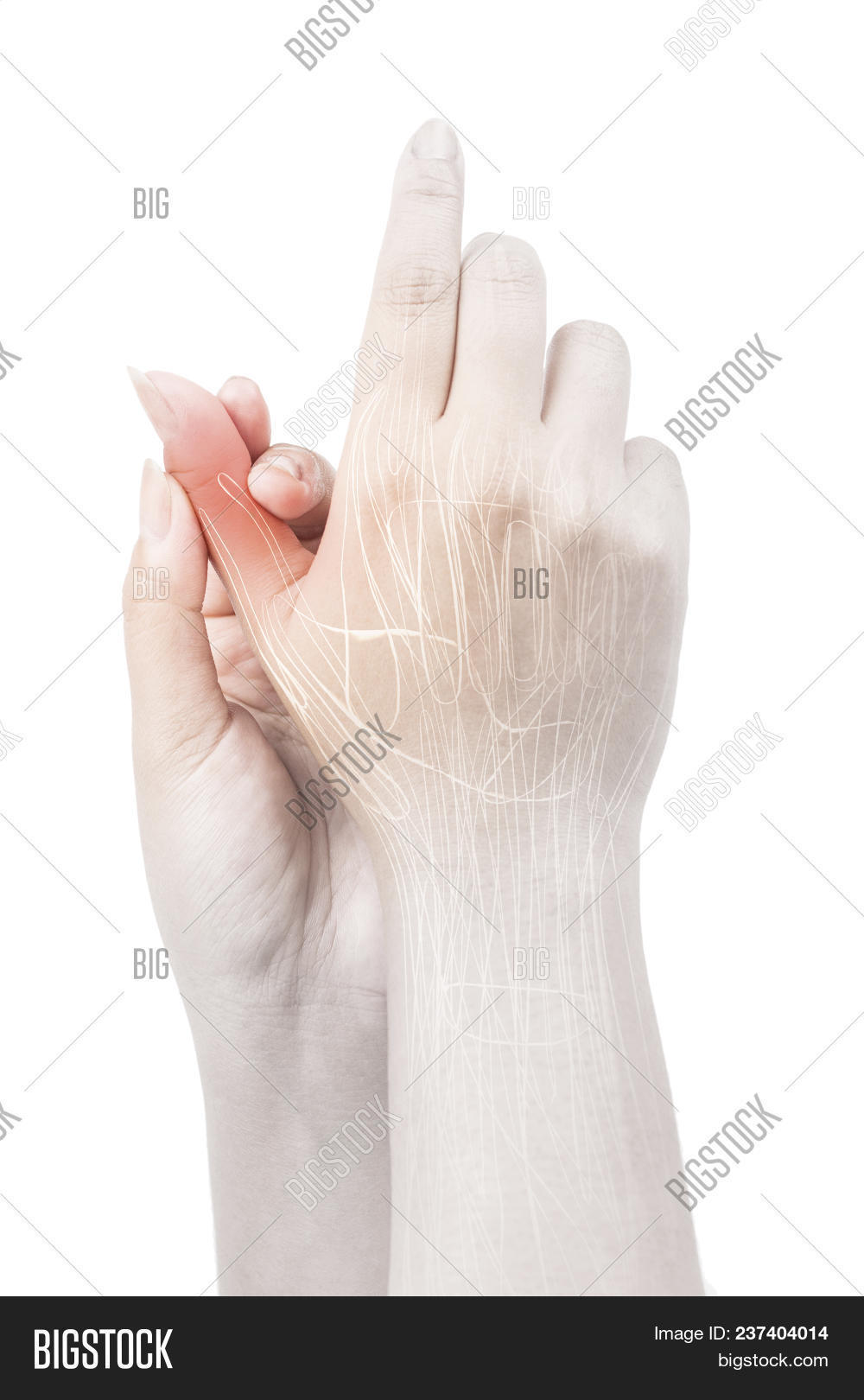 Finger Muscle Pain Image & Photo (Free Trial) | Bigstock